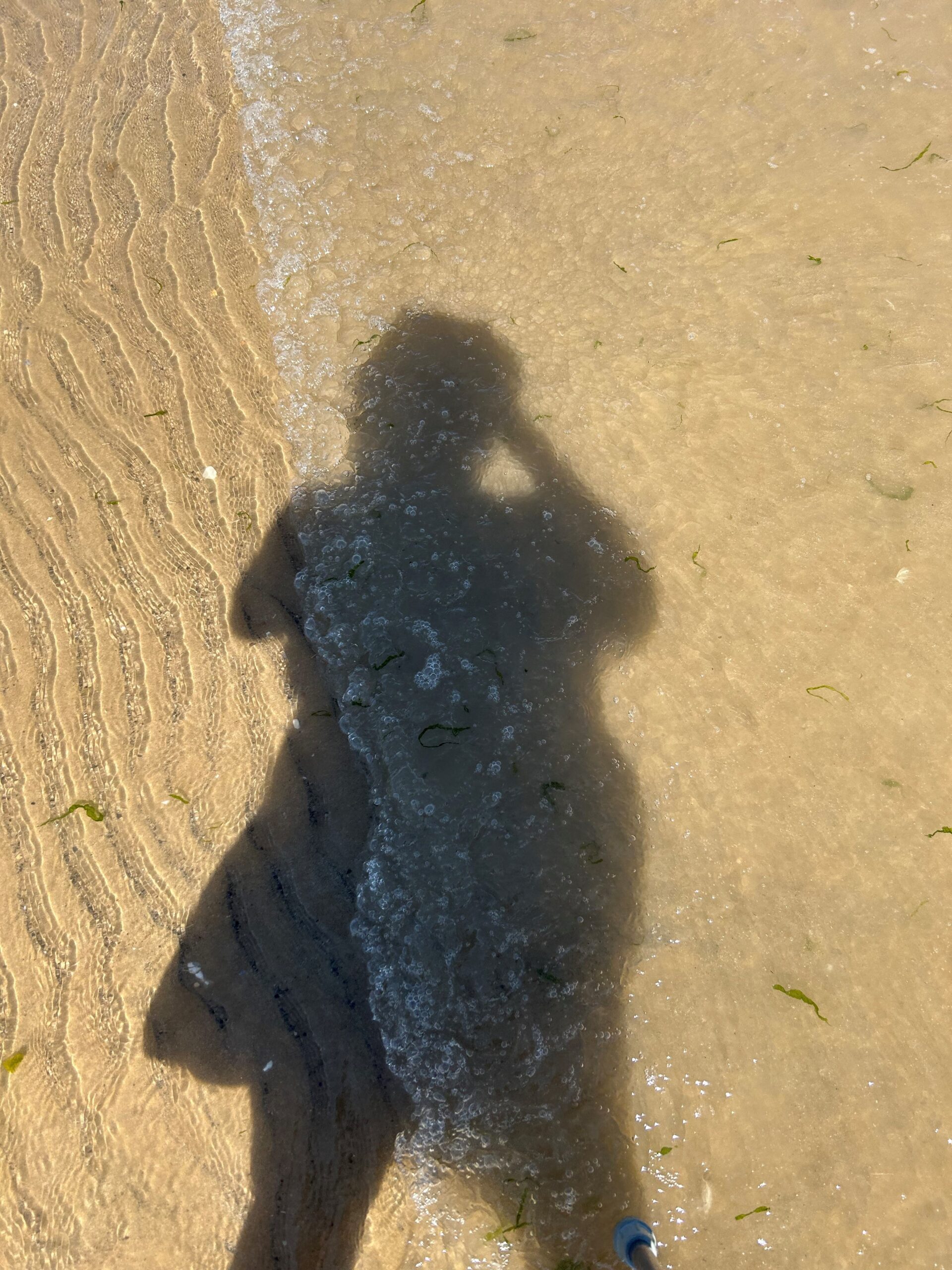 Caroline's story | Brain & Spine Foundation